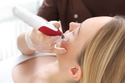 How Microneedling Benefits Your Skin Annapolis And Severna Park Md