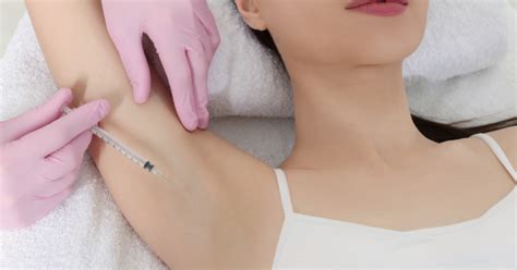 Hyperhidrosis And Botox A Comprehensive Guide Allbotox