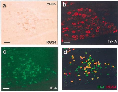 Cellular Localization Of Rgs4 Transcript Expression In The L5 Drg Of A