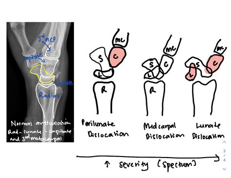 Quiz 36 Msk Radiology Cases