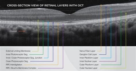 Do You Need An Oct Scan At Your Next Eye Exam