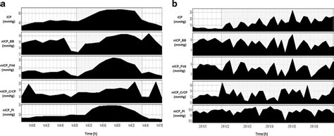 Example Of Vasogenic Waves During Infusion Test Ashadowed Area