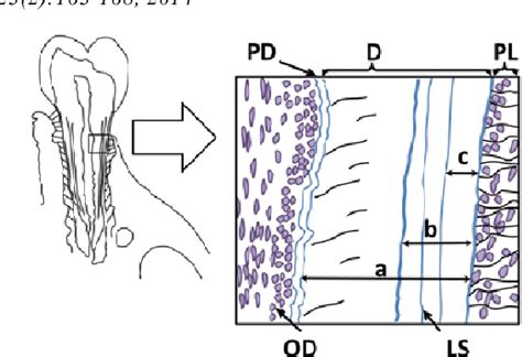 Figure 1 From Histological Analysis Of Dentinogenesis Imperfecta In