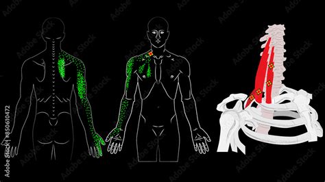 Scalene Muscles Illustration Muscles Trigger Points And Referred