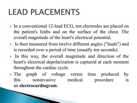 Ecg Signal Generated From Data Base Using Matlab Pptx Heart And Cardiovascular Diseases
