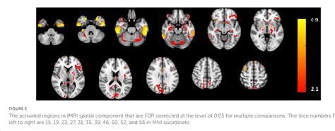 Figure 1 From Dynamic Functional Connectivity Estimation For