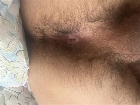 Hairy Hole Nude Pics Xhamster