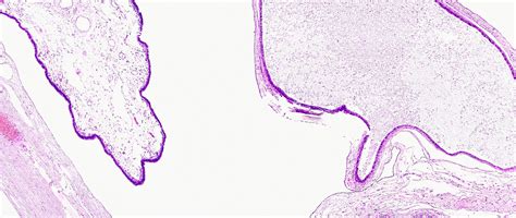 Pathology Outlines Anatomy And Histology