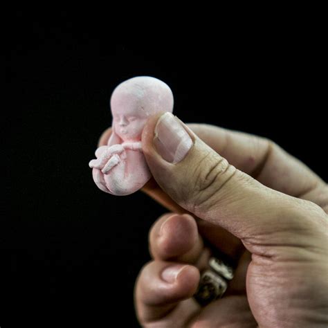 aborted human fetus