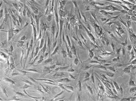 Human Adipose Derived Stem Cells Adscs Obesity Ixcells