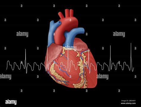 Atrial Flutter With EKG Illustration Stock Photo Alamy