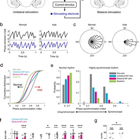 closed loop unilateral and bilateral control of temporal lobe