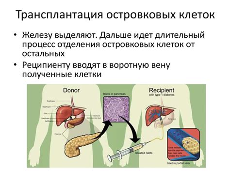 Трансплантология - создаем нового человека - online presentation