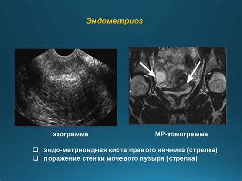 Лучевая диагностика репродуктивной системы презентация онлайн
