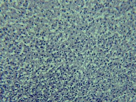 Micrograph 2 Group B Treated With 02ml Of Ethanolic Leaf Extract Of