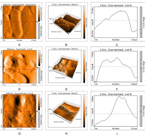 Contact Mode Atomic Force Microscopy As A Rapid Technique For Morphological Observation And
