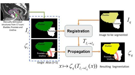 1 Atlas Based Segmentation Framework Download Scientific Diagram