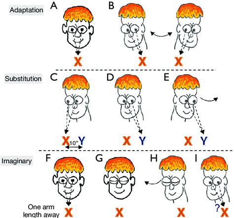 Vestibular Ocular Reflex Exercises Vestibular Ocular Reflex Vor