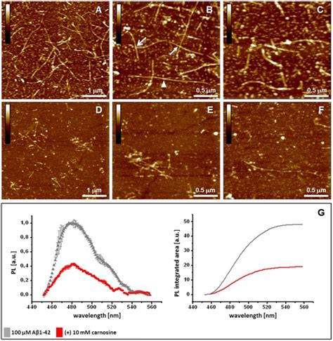 Analysis Of The Deposited Amyloid Aggregates As Assessed By Atomic Download Scientific Diagram