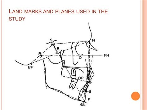Downs Analysis Original Article Pptx Downs Analysis Original Article Pptx