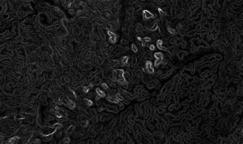 C How To Detect Light Spots In Image Stack Overflow