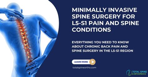 Minimally Invasive L5 S1 Spine Surgery Lower Back Pain Relief