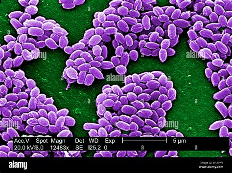 Anthrax Bacteria Shape