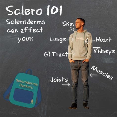 What Welcome To Sclero 101 Empowering Through Knowledge 🌟 Your Guide To Understanding