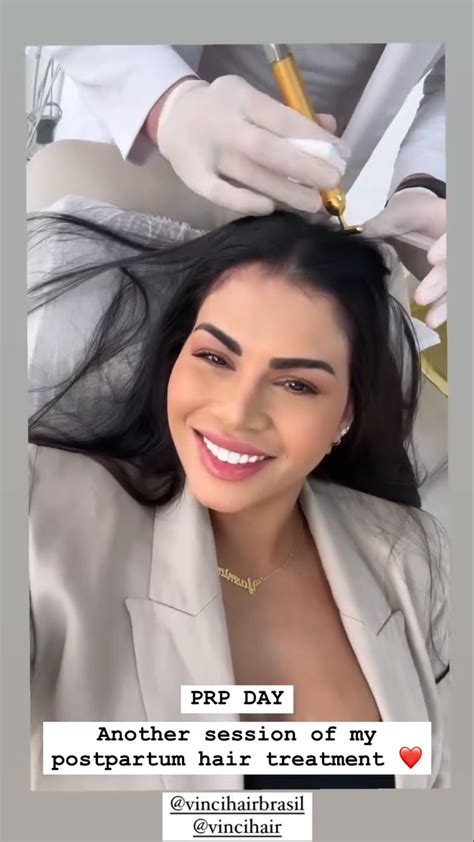 Micro Micro Scalp Pigmentation And Medical Treatments Micro Micro Scalp Pigmentation And Medical Treatments