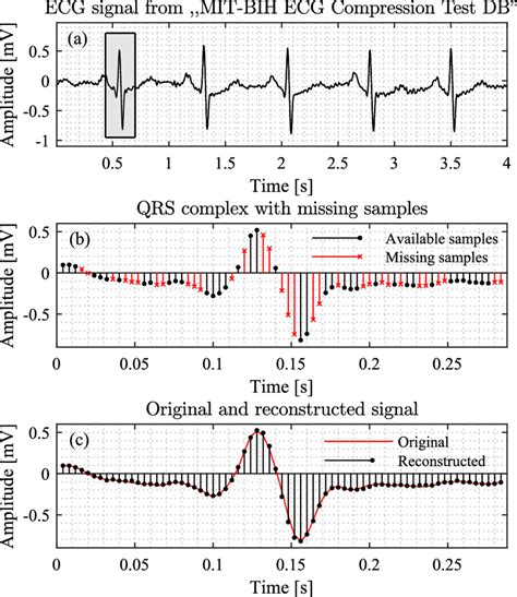 Reconstruction Of A QRS Complex With Missing Samples A The Considered Download Scientific