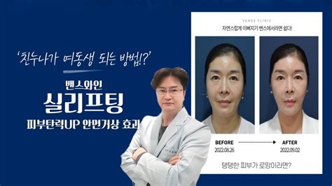 실리프팅 후기 인터뷰 밴스와인 실리프팅 효과 청주피부과 청주필러 청주실리프팅 Youtube
