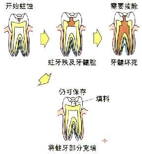 牙齿描述位置 牙齿位置描述图十字 牙齿缺齿十字书写格式 大山谷图库
