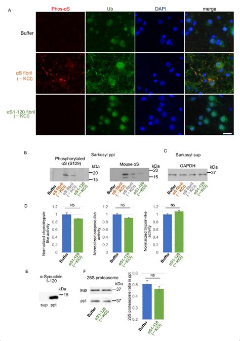 Effects Of C Terminal Truncated A Synuclein Fibrils On Proteasome In