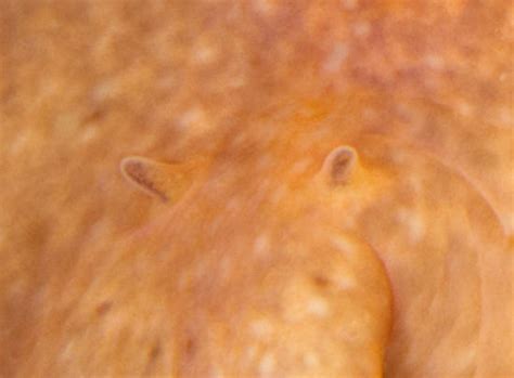 Platyhelminthes Species