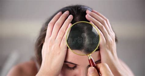 Itchy Head Scalp Stock Photo Image Of Loss Fall Annoying