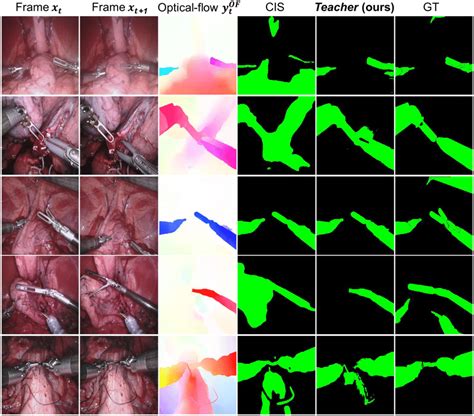 Optical Flow Segmentation On Endovis2017vos Qualitative Results