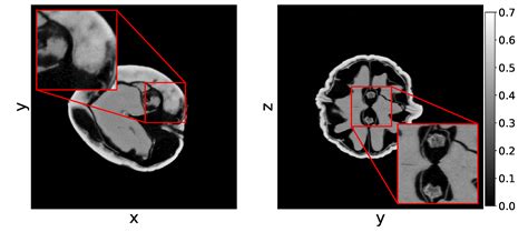 A Computationally Efficient Reconstruction Algorithm For Circular Cone