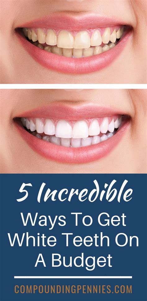 Teeth Treat How To Make Your Teeth White Fast At Home