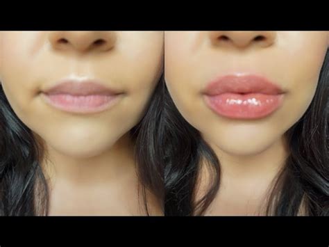 How To Make Lips Bigger Permanently Without Surgery Lipstutorial Org