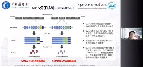 陈丽平副教授谈脊髓性肌萎缩症sma携带者筛查 新闻中心 深圳会众生物技术有限公司