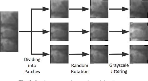 Figure 3 From Classification Of The Cervical Vertebrae Maturation Cvm Stages Using The Tripod