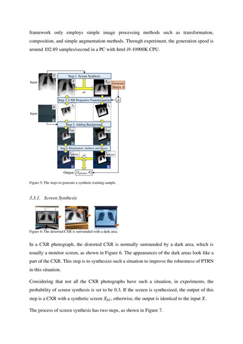 Projective Transformation Rectification For Camera Captured Chest X Ray