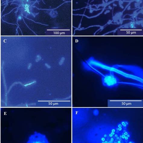 Fragmentation Of Filamentous Microfungal Colonies Resulting From A Download Scientific Diagram