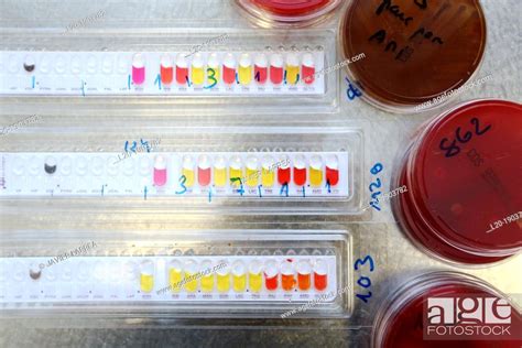 Api Microbiology Test Identifying Bacteria Laboratory Technician