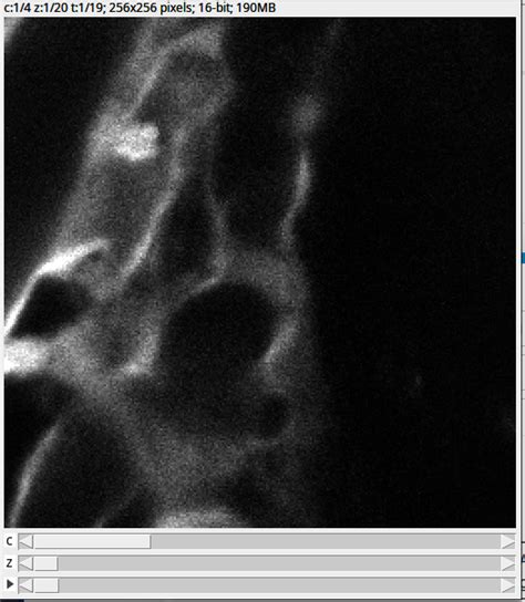 need assistance into issue with denoising using careamics noise2void