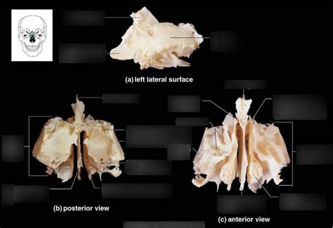 Ethmoid Bone Diagram Quizlet