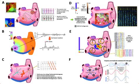 Schematics Of Basket And Sequential Electrogram Based Mapping Download Scientific Diagram