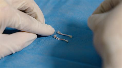 Trabecular Bone Microarchitecture Evaluation In An Osteoporosis Mouse