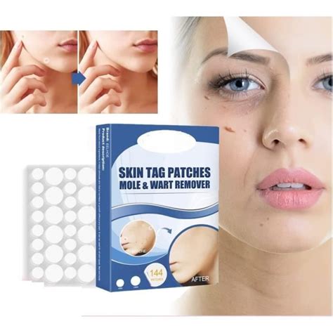 Skin Tag Removerpatch Détiquettes De Peauverrue Patchpatch Anti