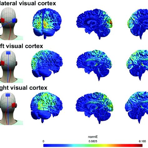 Effects Of Transcranial Random Noise Stimulation Trns On Perceptual Download Scientific